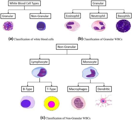 Detection and classification of leukocytes in leukemia using YOLO and ...